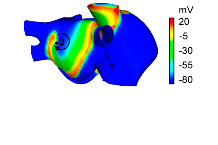 Spanish Network On Cardiac Computational Modeling Was Born — Non Linear Physics And Out Of